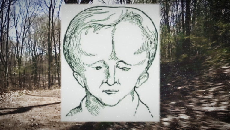 The spooky mystery of the "Melonheads" eerie-looking children, that ...