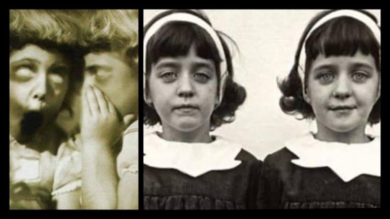 The Mystery Of The Pollock Twins, A Case Of Reincarnation - Mundo Seriex